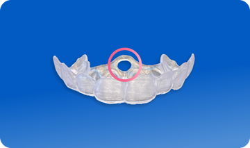Correct Your Tongue Placement. – Spot Pal